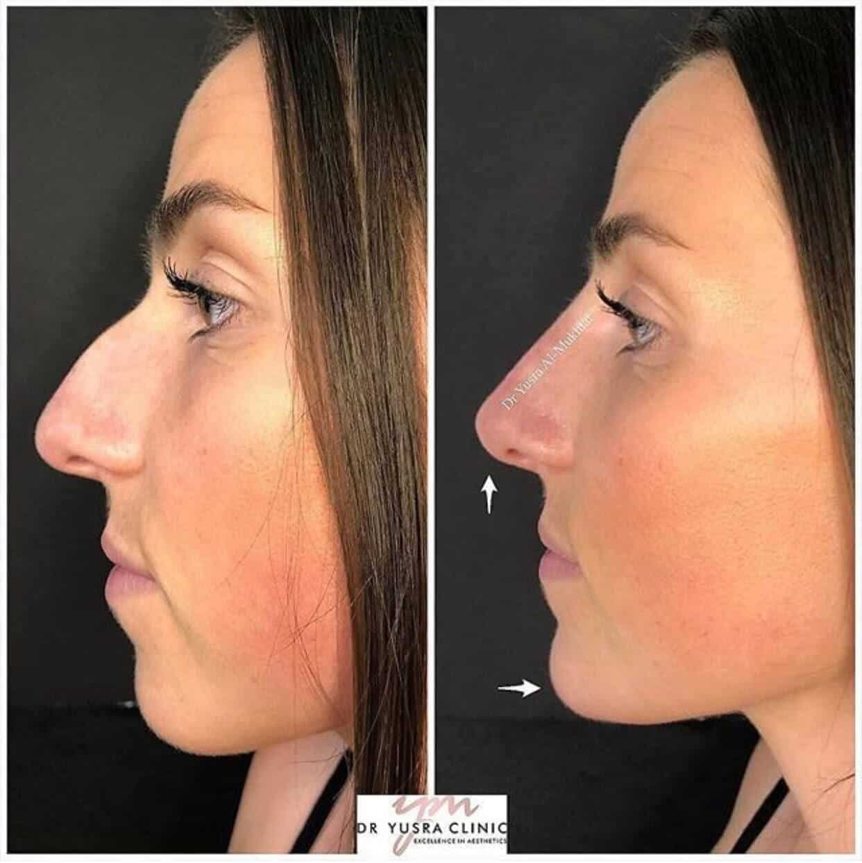 Profile Balancing: What Is It & Where Can You Book? - Aesthetics Clinics